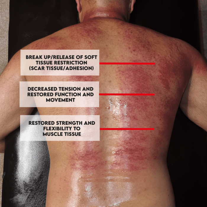 Kinetic Therapy - The Human Architect